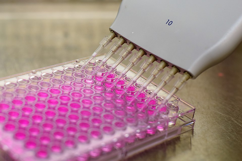 Fastest Pipette in the West (of Dundee) | Dundee Science Centre